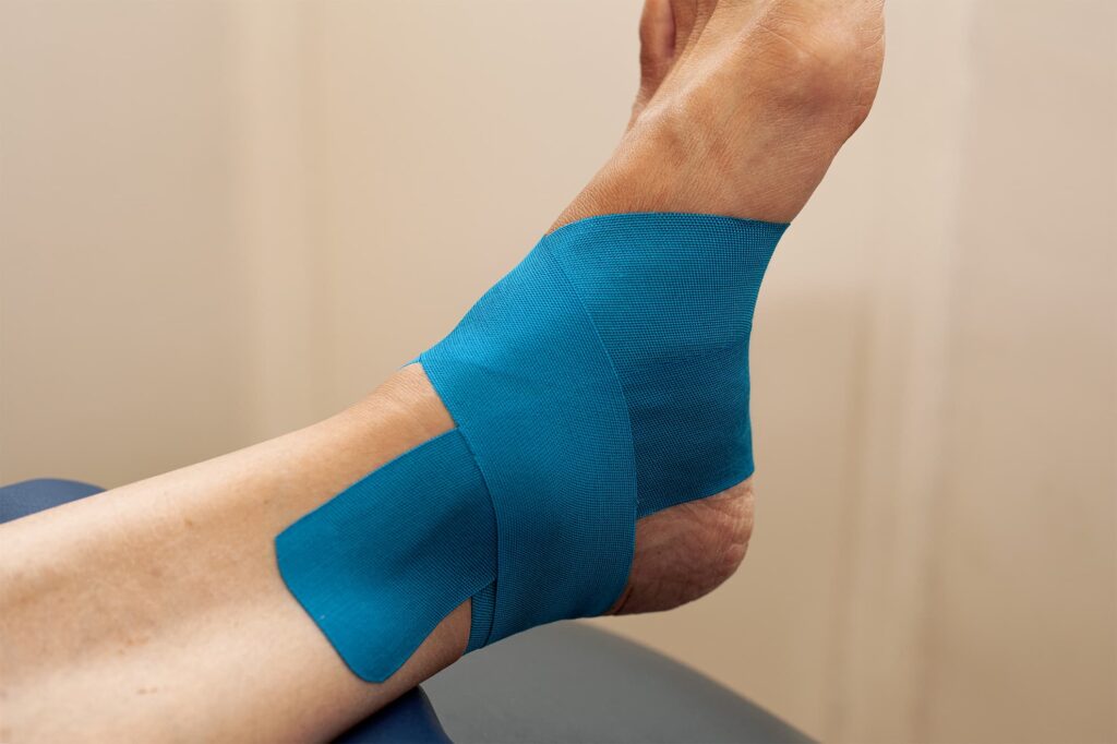 Revalidatietraject na een enkelbreuk | Fysioplein